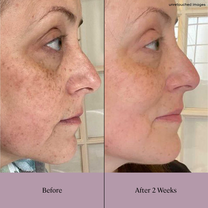 Daily At Home Facial Kit - EVER Skincare
