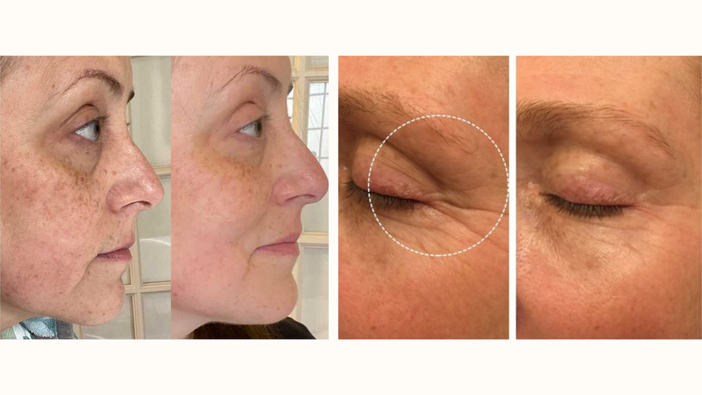 EVER Skincare - Clean Skincare For Women in their 30s and Beyond