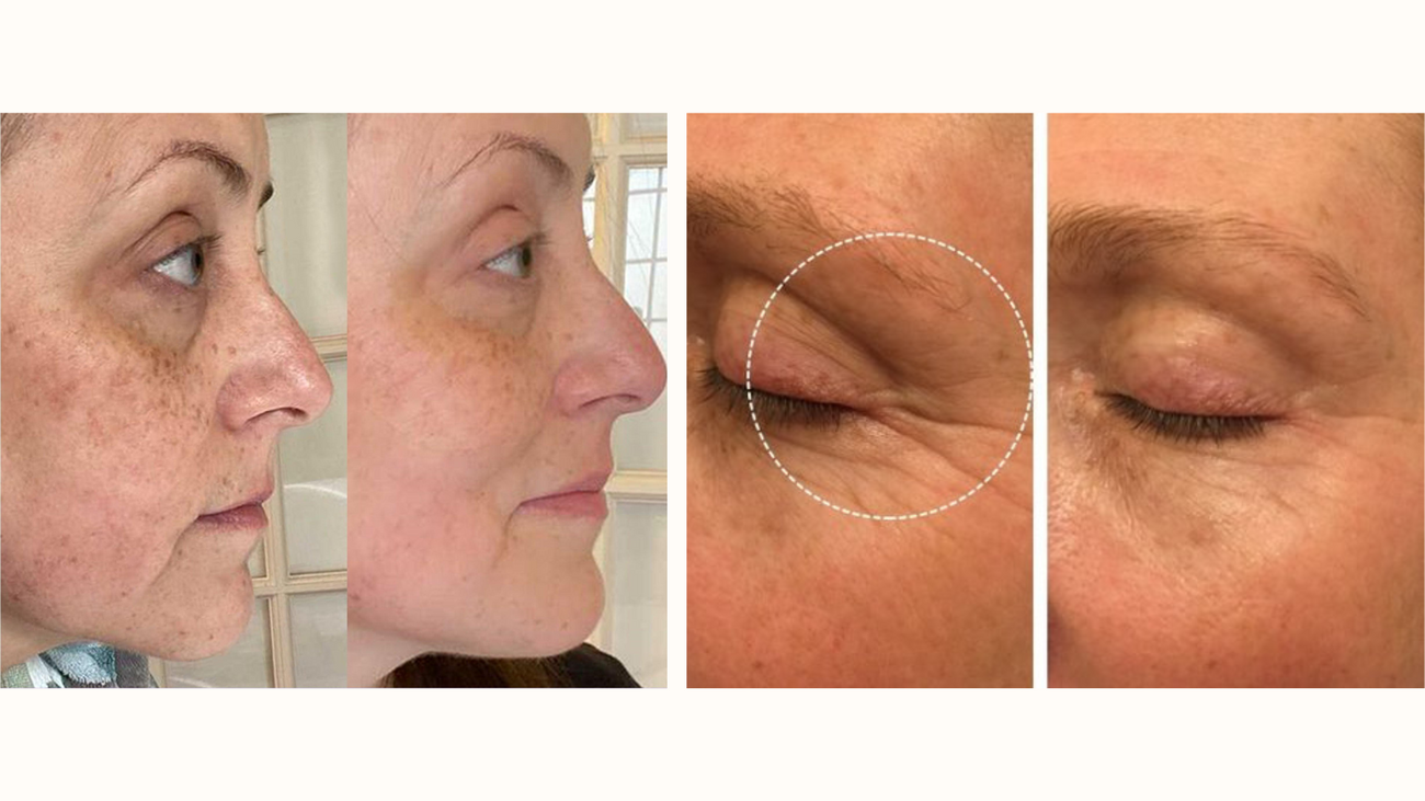 EVER Skincare - Clean Skincare For Women in their 30s and Beyond